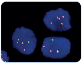 FISH probes for trisomy diagnosis Clinisciences