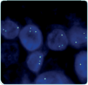 Test de nieuwe ALK probe voor FISH automatisering Clinisciences
