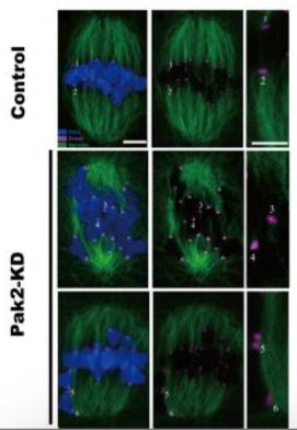 15-234 | Anti-Centromere Protein Antibody Clinisciences