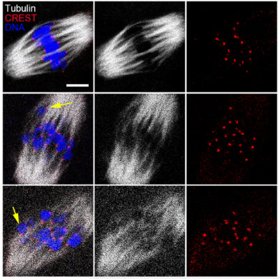 15-234 | Anti-Centromere Protein Antibody Clinisciences