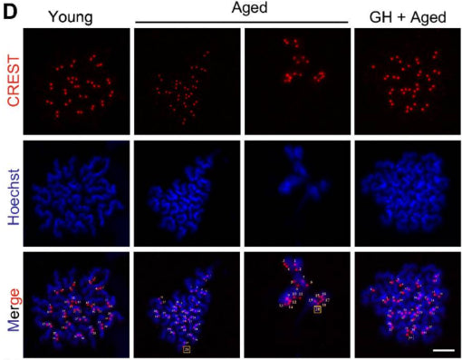 15-234 | Anti-Centromere Protein Antibody Clinisciences