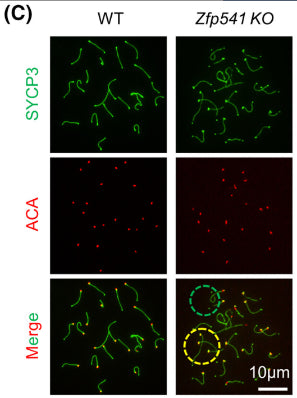 15-234 | Anti-Centromere Protein Antibody Clinisciences