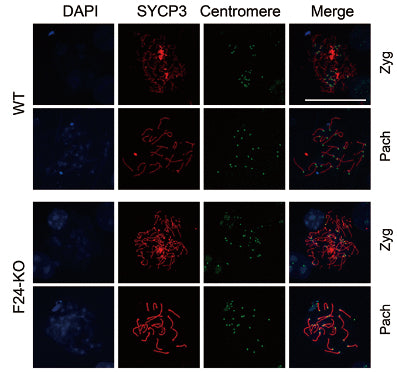 15-234 | Anti-Centromere Protein Antibody Clinisciences