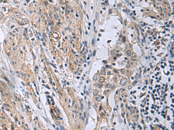 E-AB-19517-20 | MBL2 Polyclonal Antibody Clinisciences