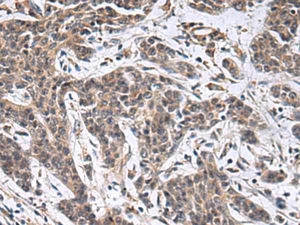 E-AB-19517-20 | MBL2 Polyclonal Antibody Clinisciences