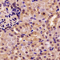 CQA1362-200ul | Rabbit Anti-Pancreatic Lipase Polyclonal Antibody