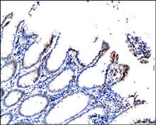 250804 | Rabbit Anti-p16-INK4 Polyclonal Antibody Clinisciences