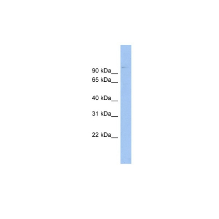 ARP42252_P050-FITC | ABCB6 Antibody - middle region : FITC Clinisciences