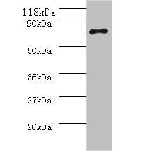 Orb240675-50ug | Helicobacter pylori Urease subunit beta antibody