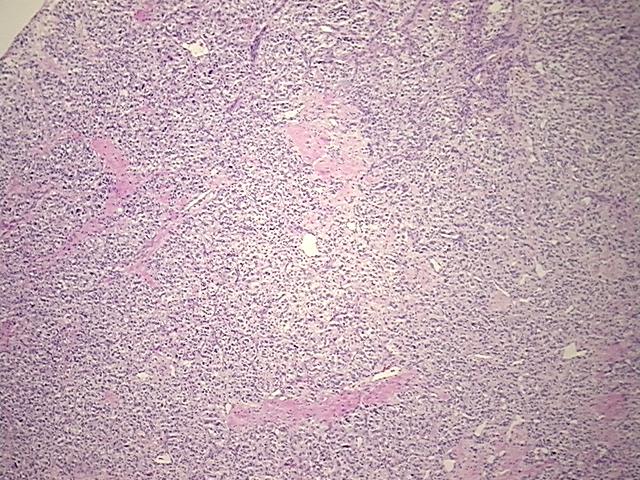 CS812467 | Tissue FFPE Sections, Adrenal gland Clinisciences