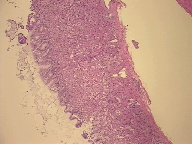 CS644334 | Frozen Tissue Sections, Stomach Clinisciences