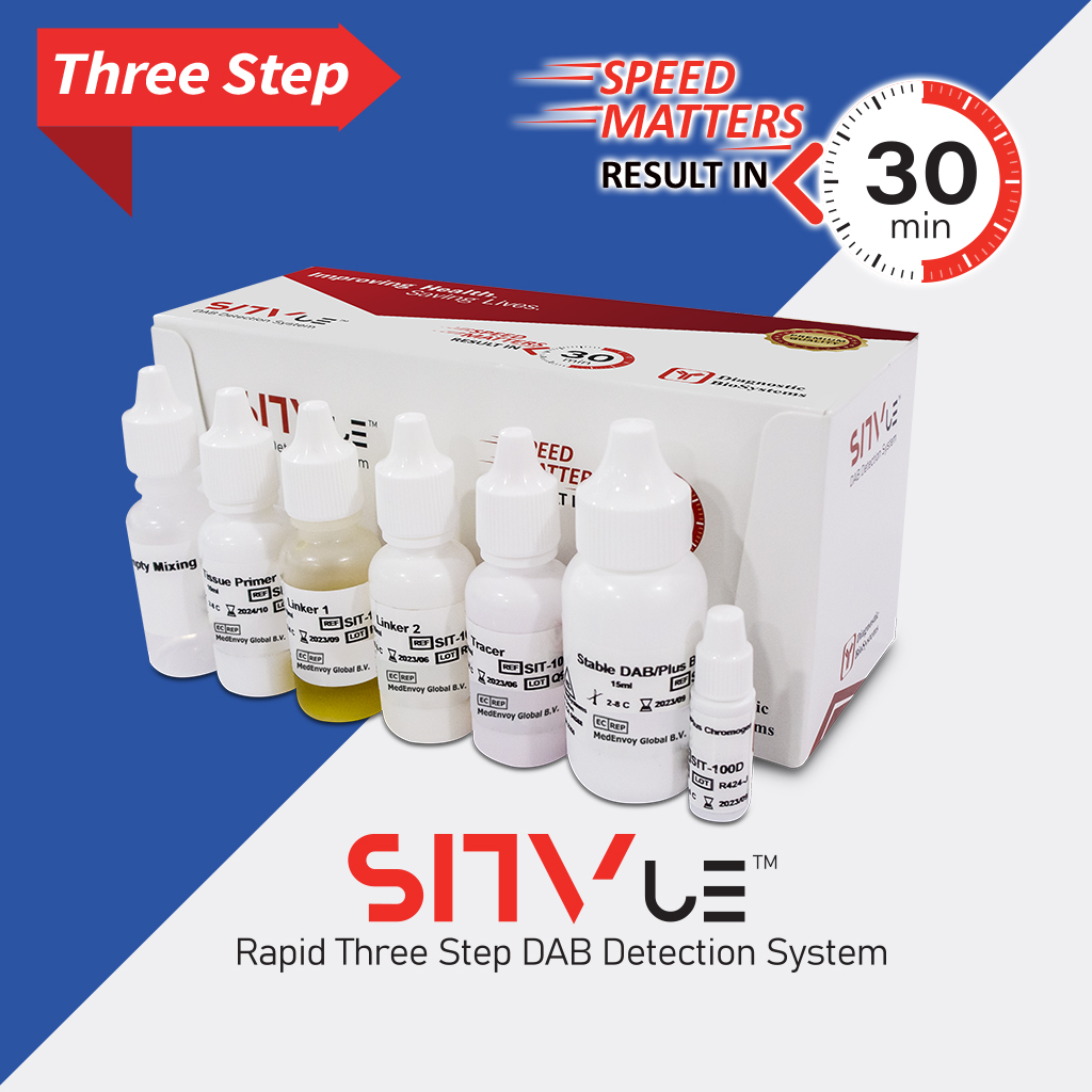 SIT-100D | SITvueTM /DAB Detection System Clinisciences