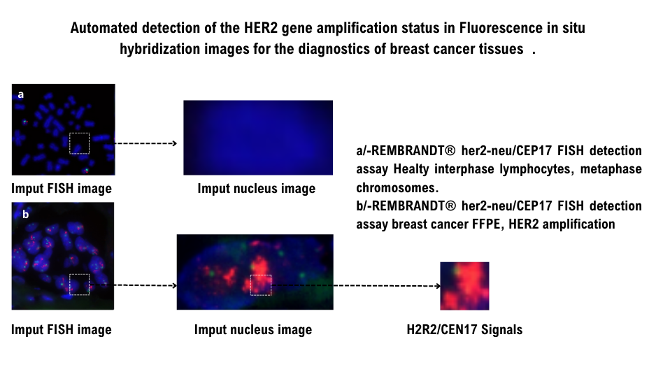 REMBRANDT® Detección de amplificación HER-2 Clinisciences