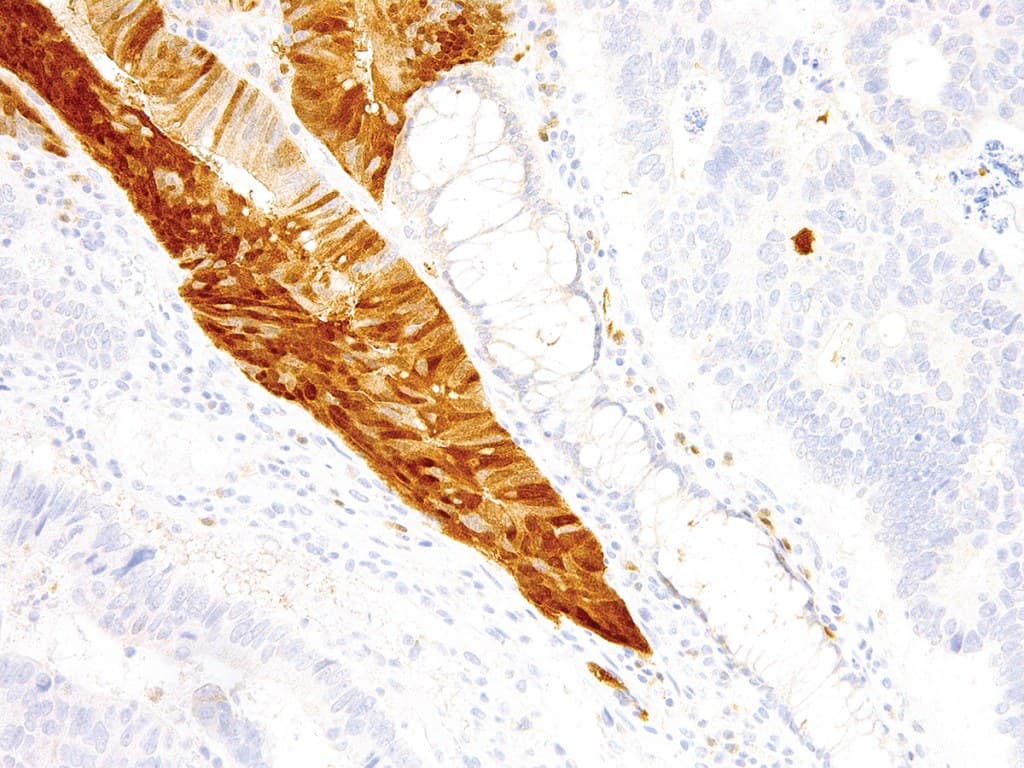 Anti-Arginasa 1 CE/IVD para IHC - Patología gastrointestinal Clinisciences