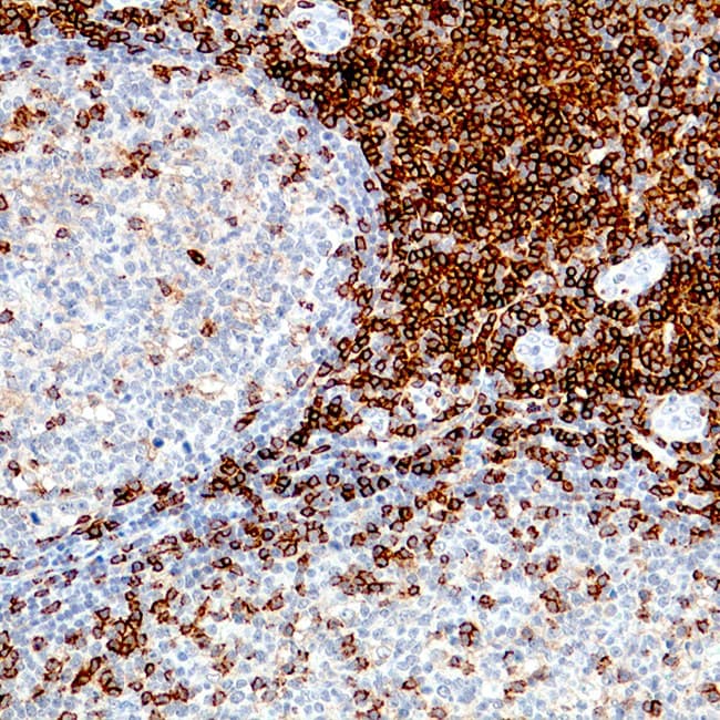 Anti-CD4 CE/IVD pour IHC - Pathologies hématologiques Clinisciences