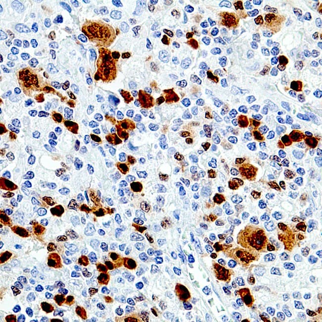 Anti-MUM1 CE/IVD para IHC - Hematopatología Clinisciences