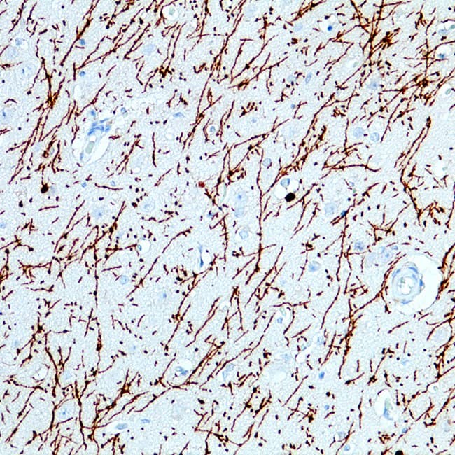 Anti-Myelin Basic Protein (MBP) CE/IVD for IHC - Neuropathology ...