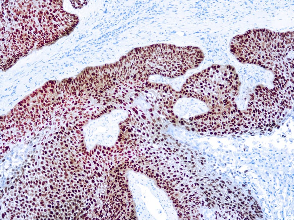 Anti-p63 CE/IVD pour IHC - Dermatopathologie Clinisciences