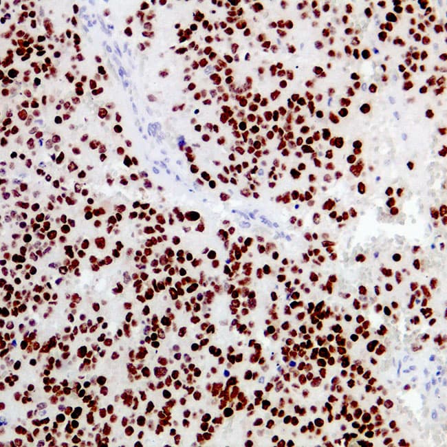 Anti-PHOX2B CE/IVD pour IHC - Pathologie pédiatrique Clinisciences