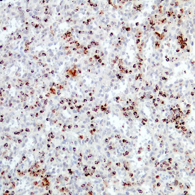 Anti-TIA1 CE/IVD para IHC - Hematopatología Clinisciences