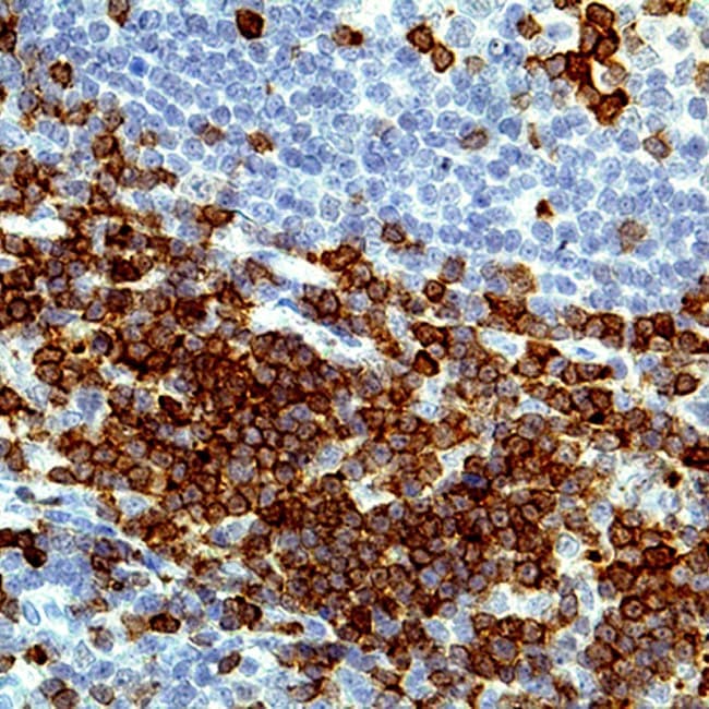 Anti-ZAP-70 CE/IVD para IHC - Hematopatología Clinisciences